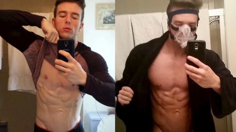 All You Need To Know About Melanotan - Biid.org